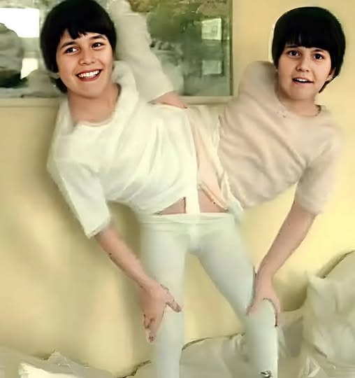Born Joined at the Pelvis: Twins Share 3 Legs and Organs! Their ...
